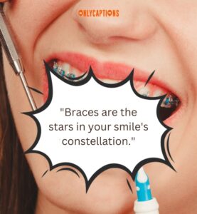 910+ Braces Quotes (2025) Grin and Bear It with Humor